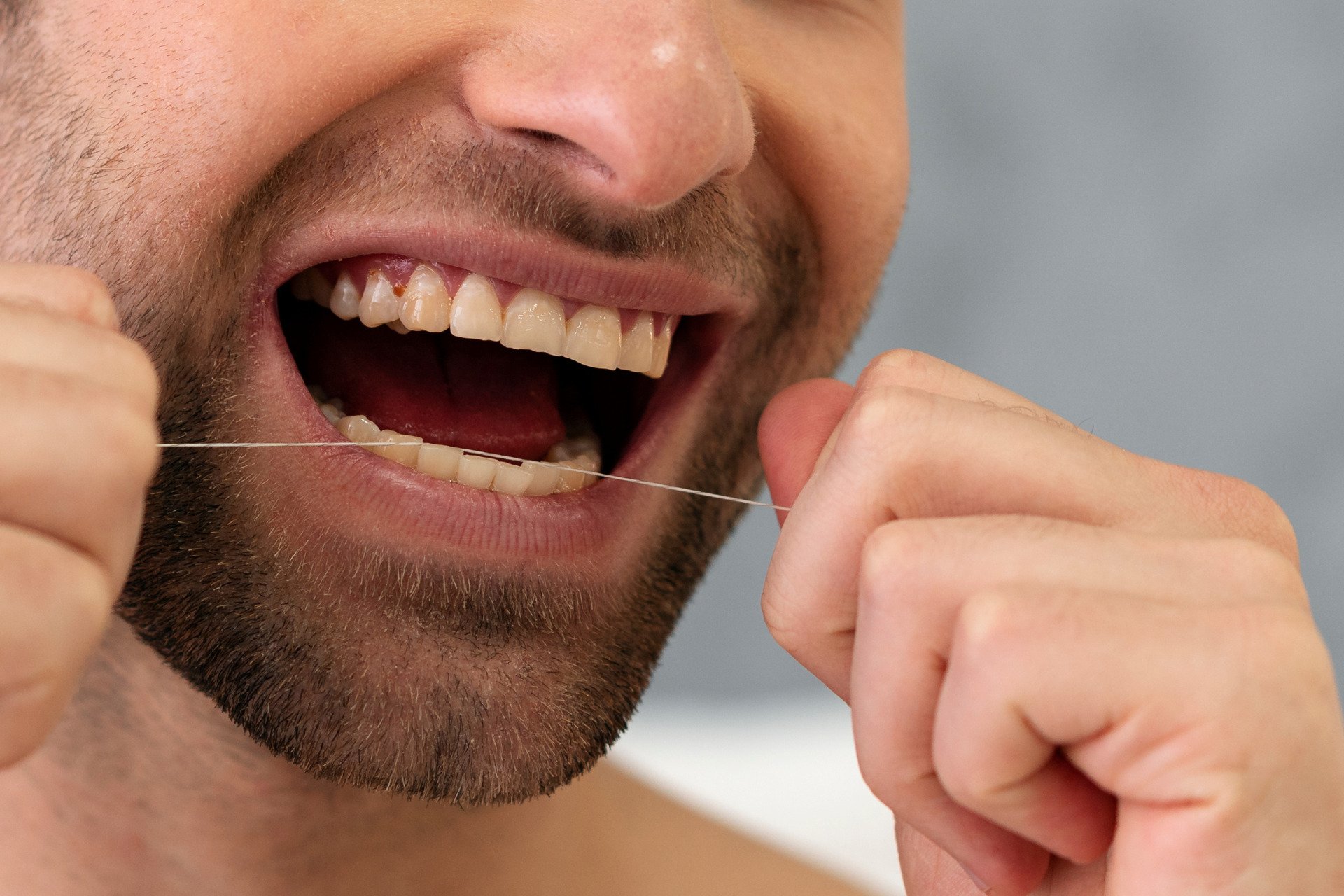 Dental Floss Could Deliver Next-Gen Vaccines, No Needles Required | Pro ...